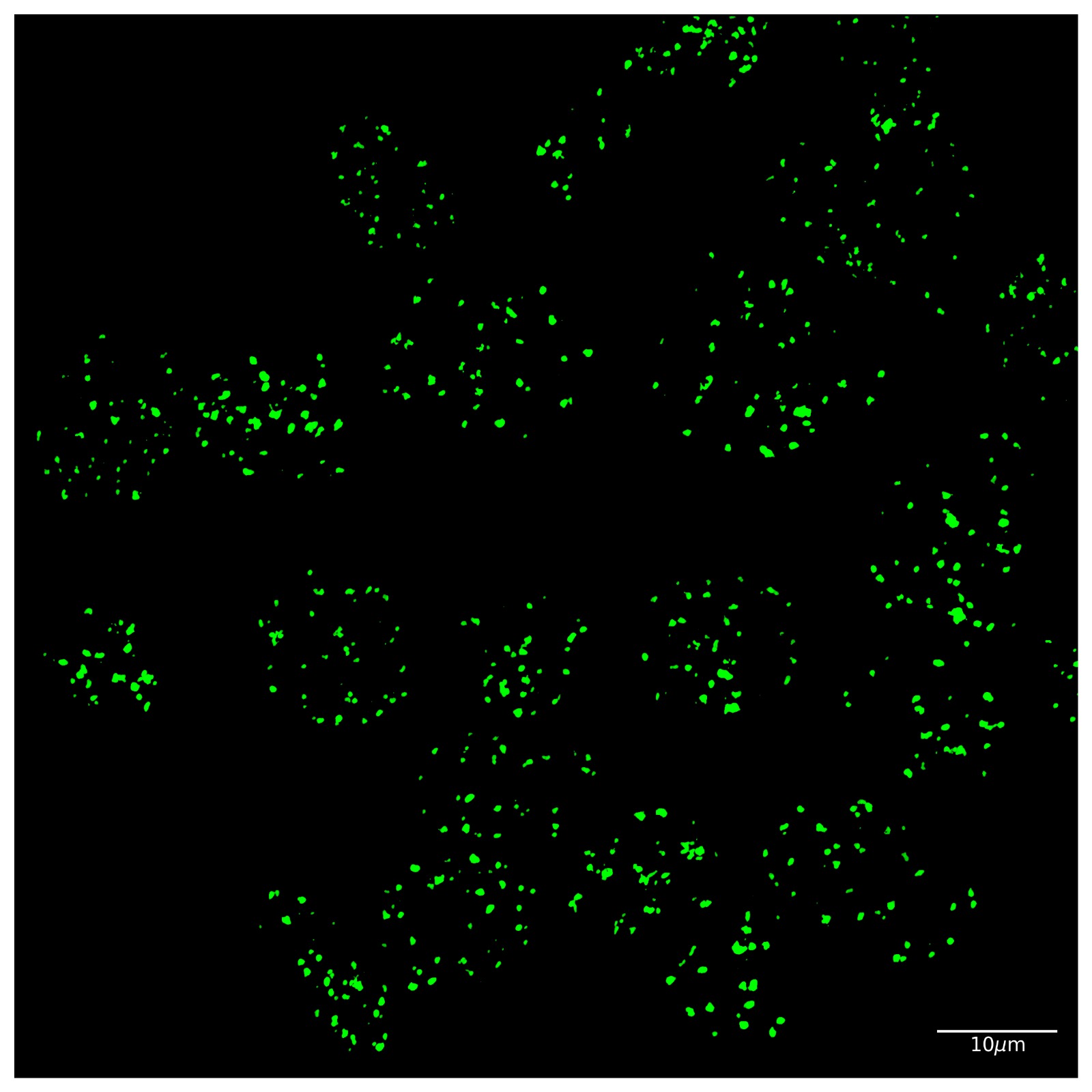 Foci Counter | NUS Physics