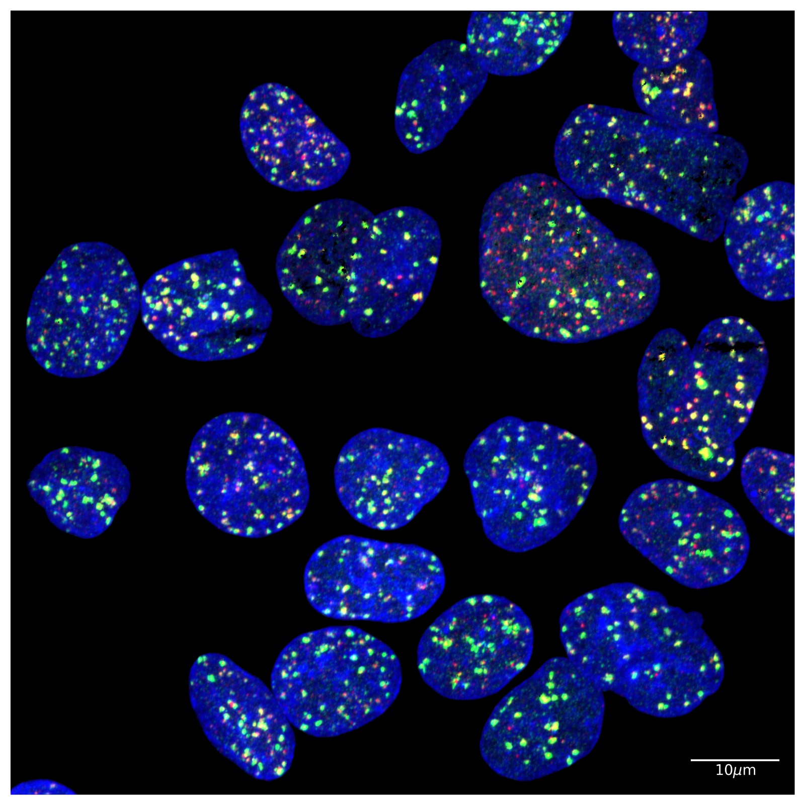Foci Counter | NUS Physics