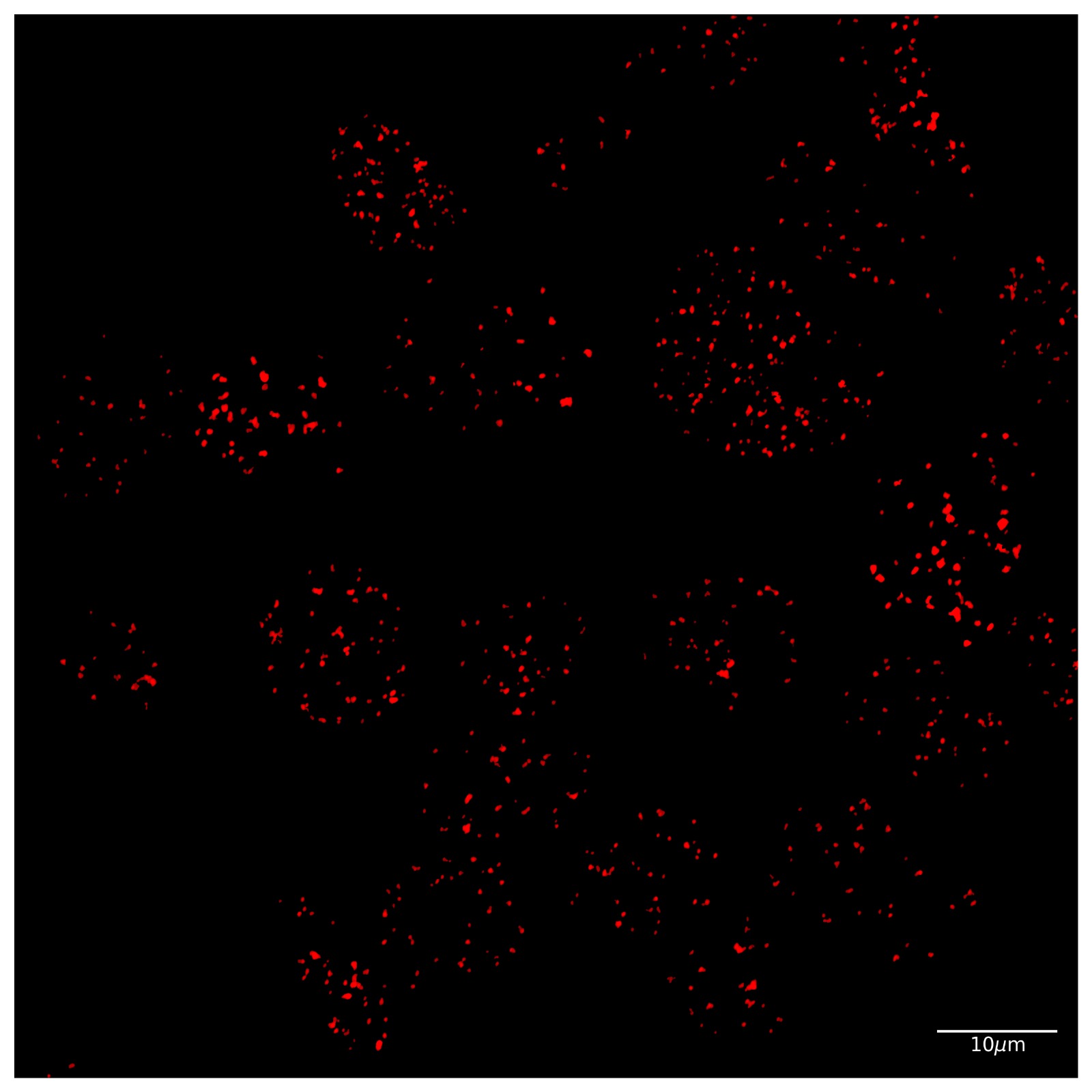 Foci Counter | NUS Physics